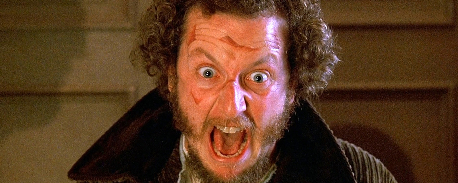 Varning! Fråga inte "Ensam hemma"-skådisen om hans skador | MovieZine